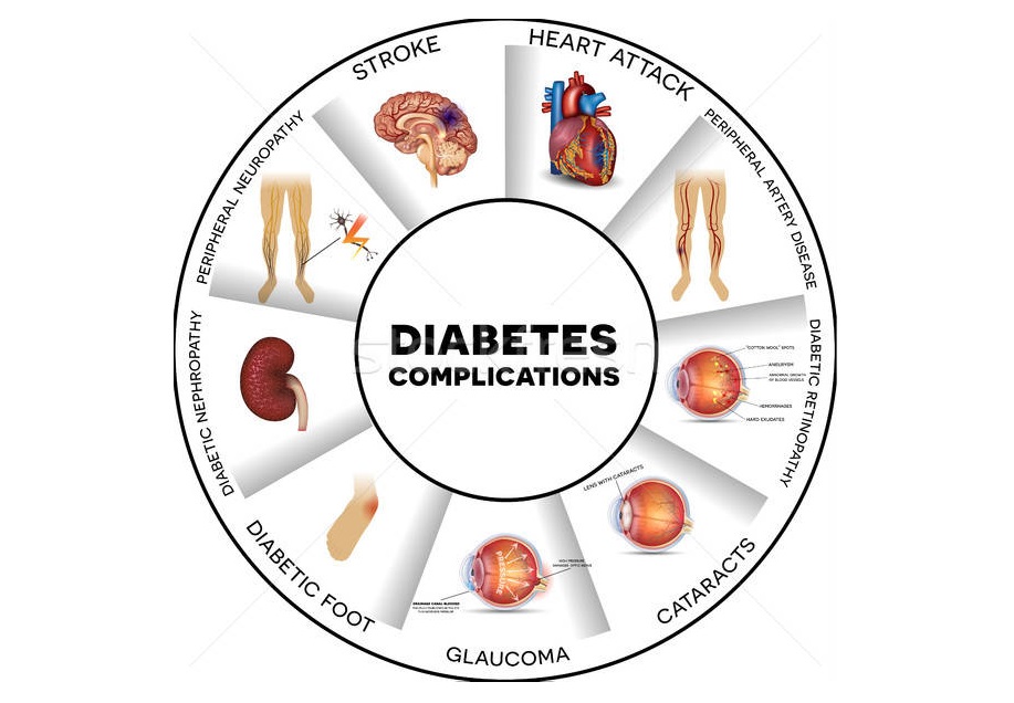 Diabetes Tipo 2